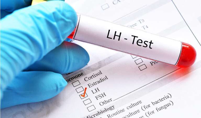 LH Blood Test | Luteinizing Hormone (LH) Levels & Importance